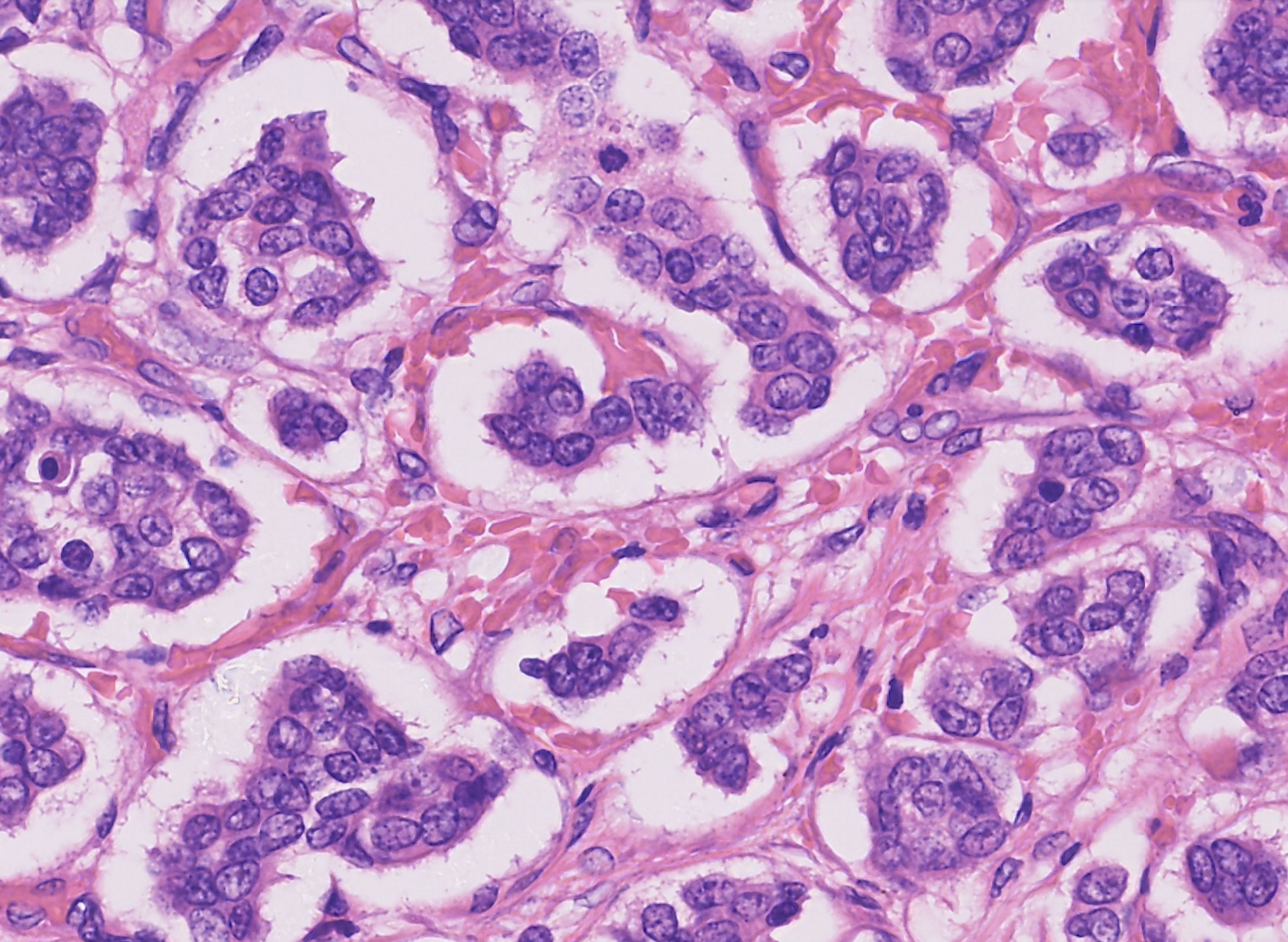 Pramana - True digital transformation for next-generation pathology
