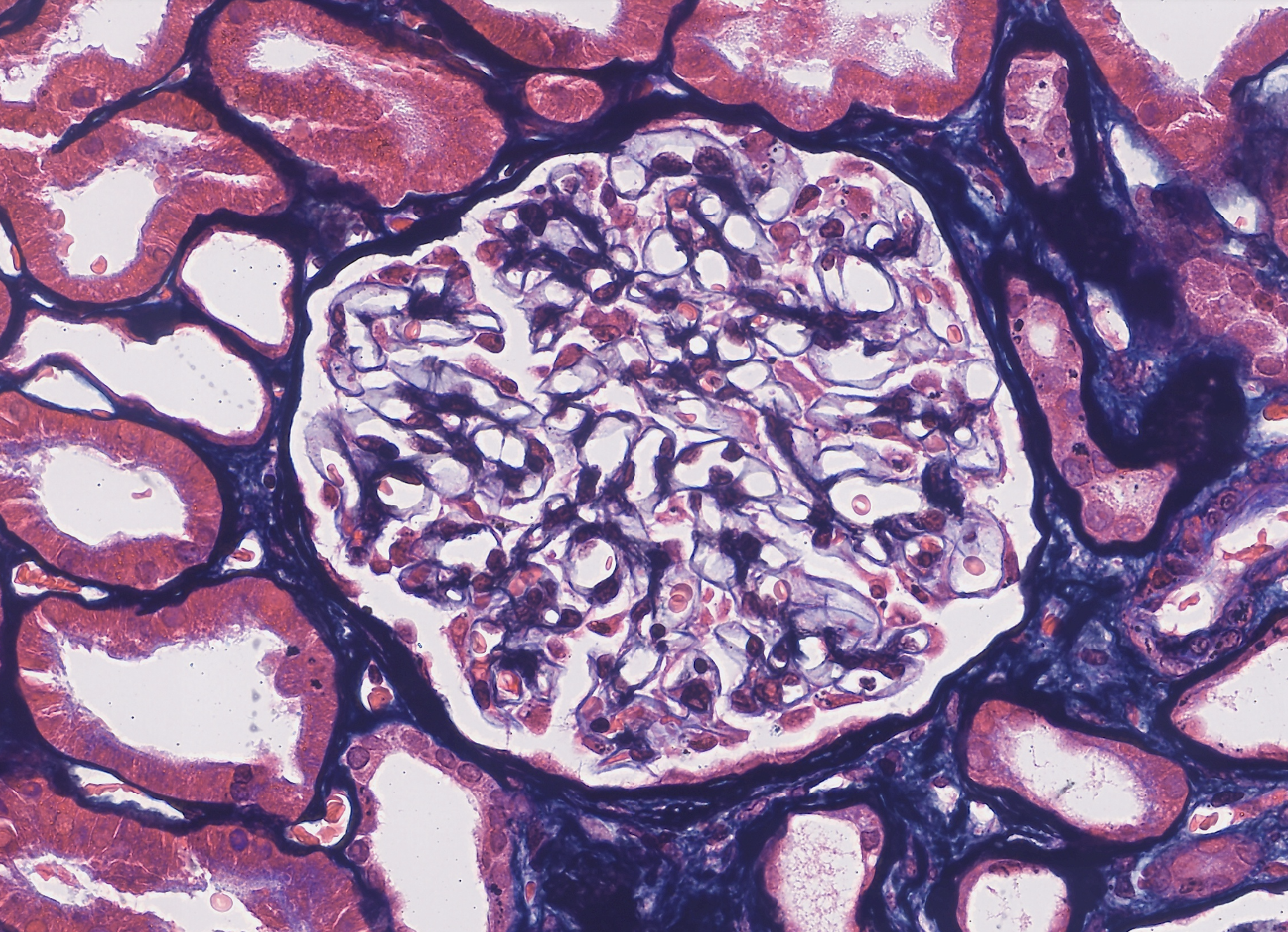 Pramana - True digital transformation for next-generation pathology