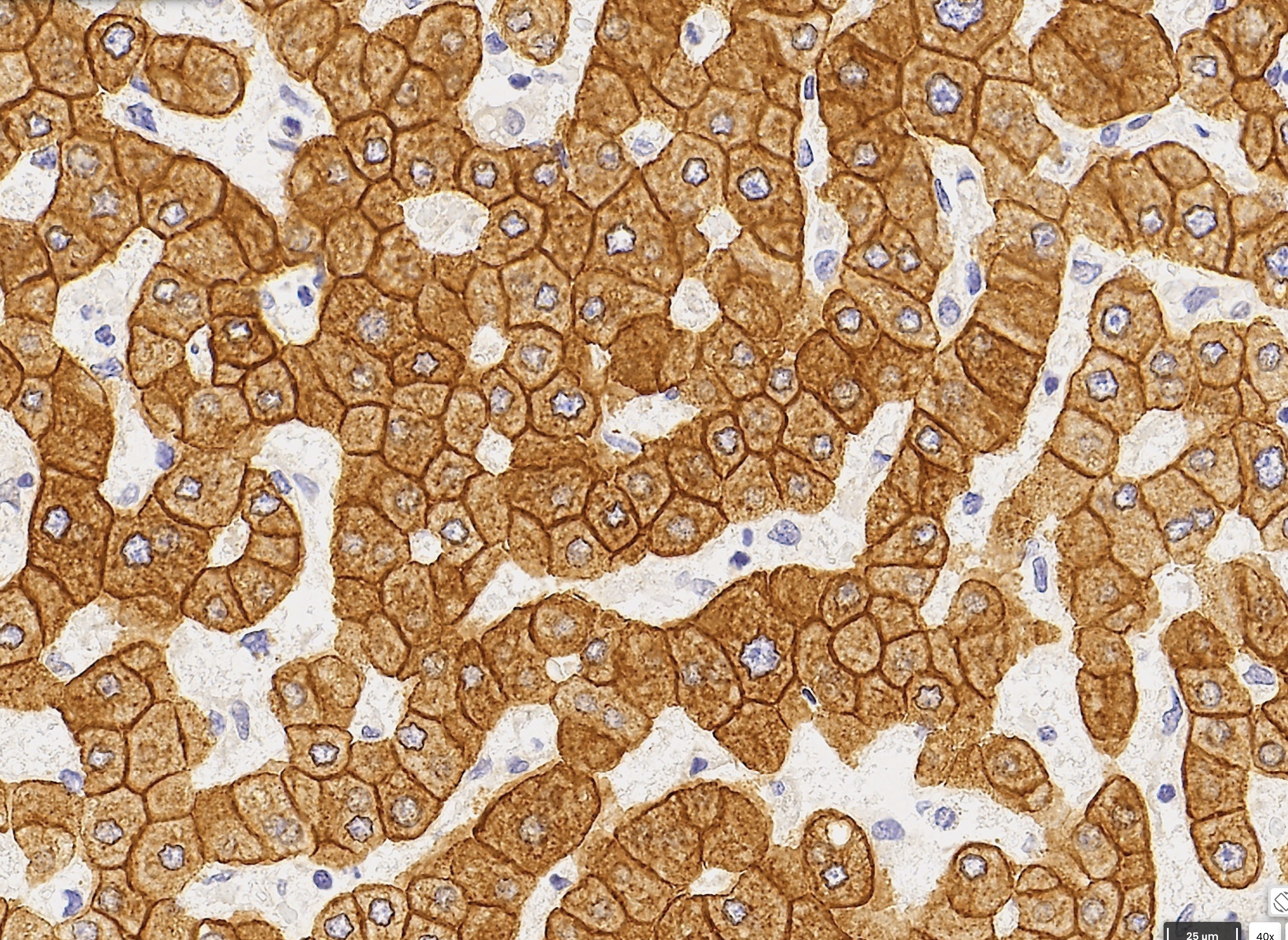 Pramana - True digital transformation for next-generation pathology