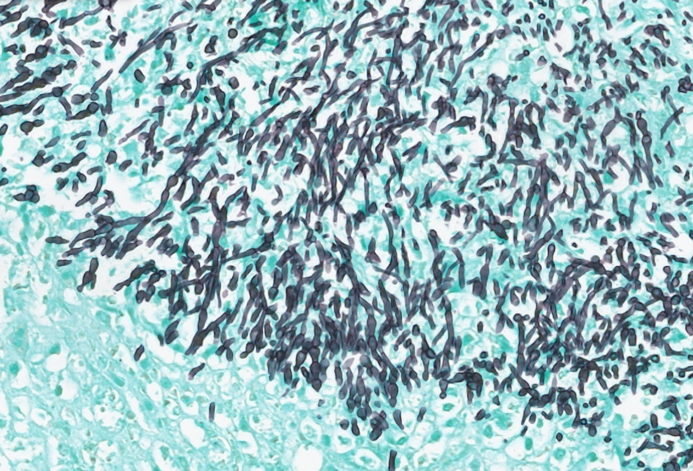 Pramana - True digital transformation for next-generation pathology