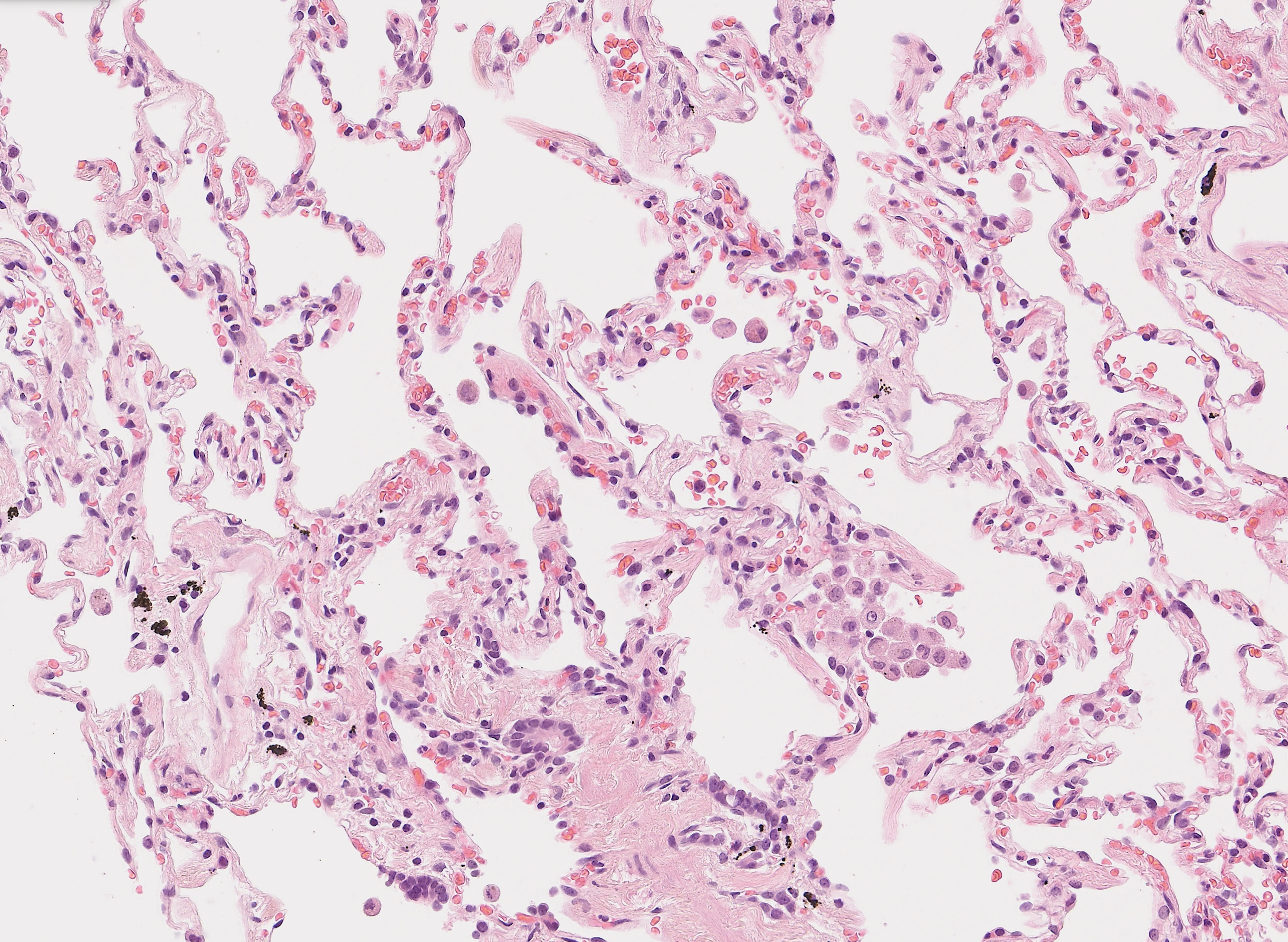 Pramana - True digital transformation for next-generation pathology